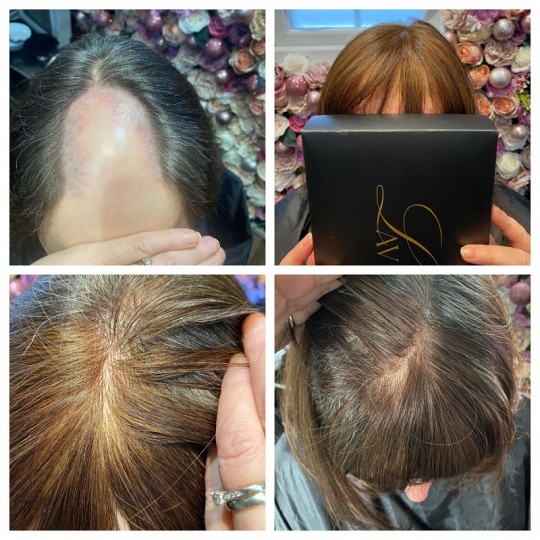 Women Long Hair System to Cover Hair Loss