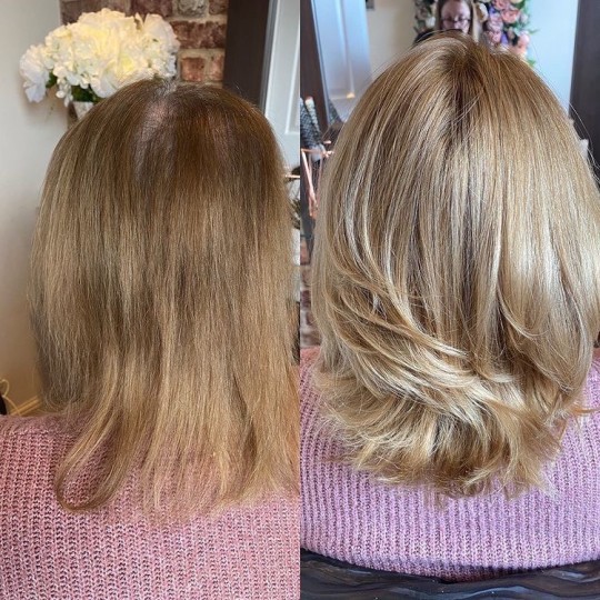 Women Long Hair System to Cover Hair Loss