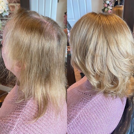 Women Long Hair System to Cover Hair Loss