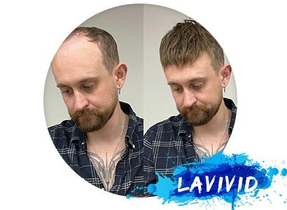 Did Frank Sinatra Wear a Toupee? – Lavivid Hair