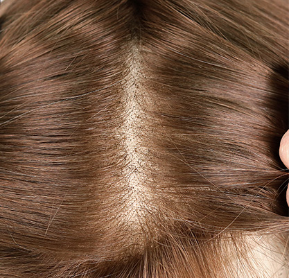 Premium European Hair Systems | Top Quality Human Hair Toupees for Men ...