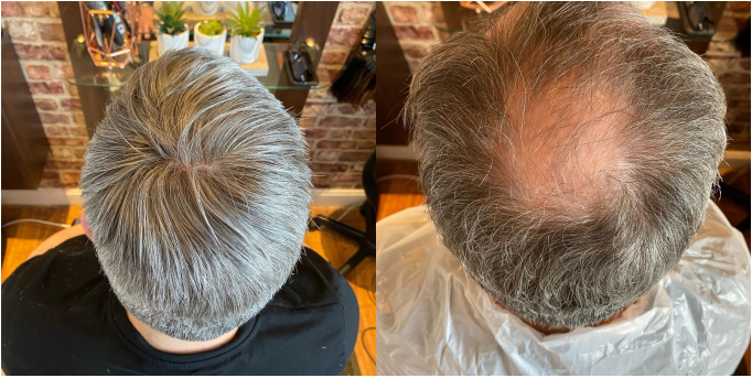 Can I Wear Grey Hair Toupee to Look Awesome? - lavividhair